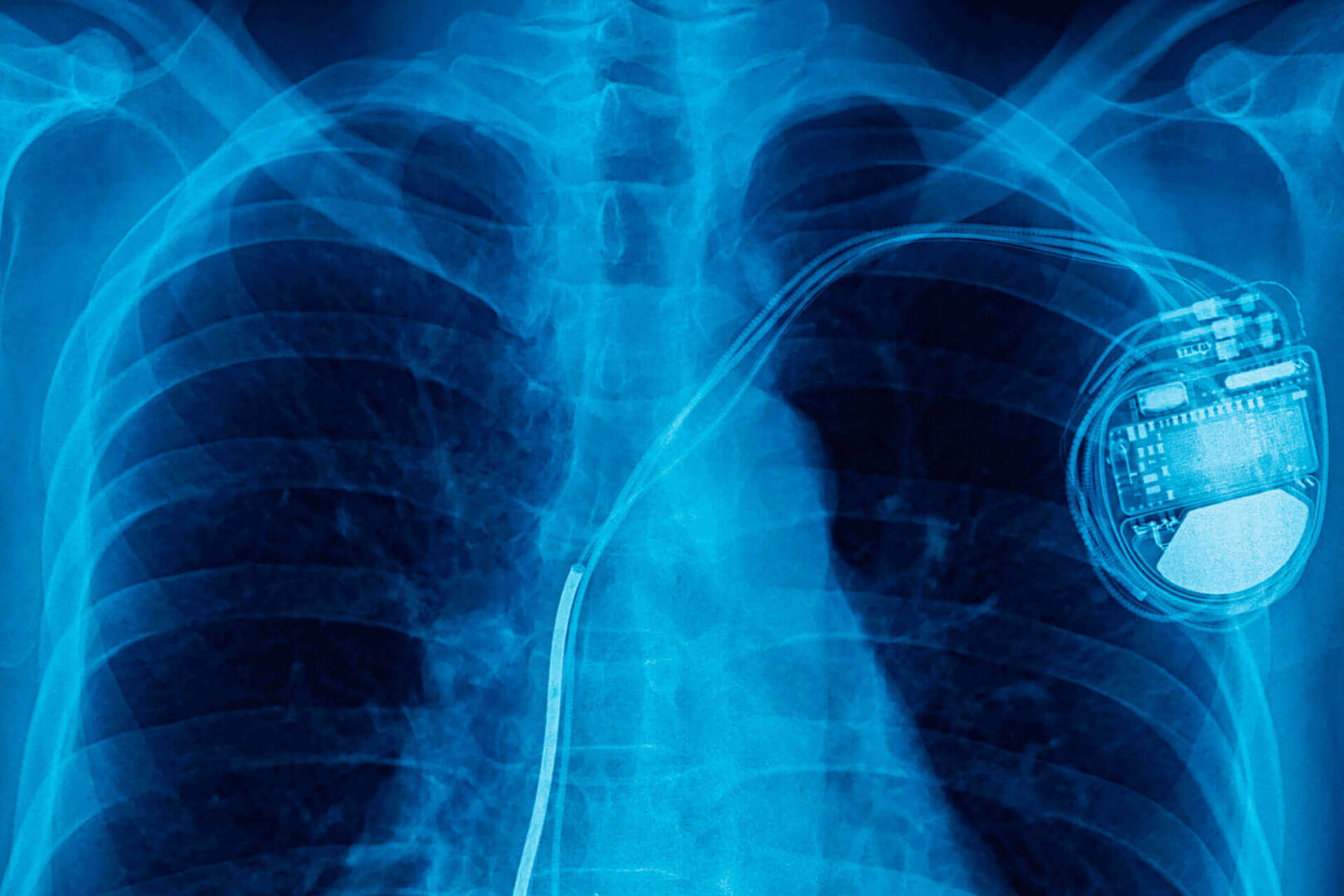 Wound healing with the help of sunlight - VELUX STIFTUNG